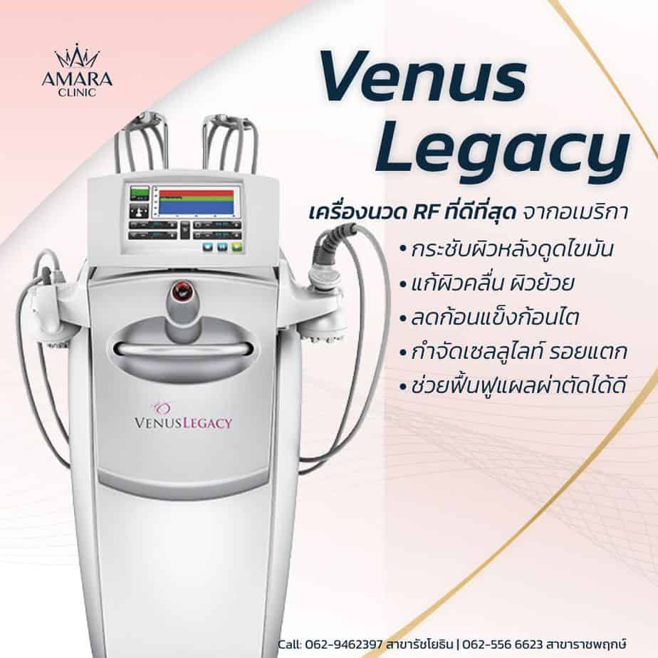 Venus Legacy นวด RF หลังดูดไขมัน กระชับผิว ลดผิวคลื่น ผิวย้วย กำจัดเซล ...