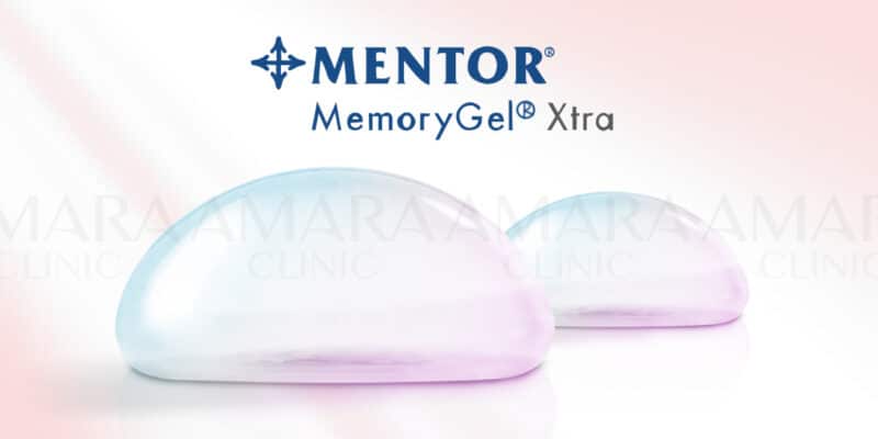 เสริมหน้าอกซิลิโคน Mentor ซิลิโคนยอดฮิตตลอดกาล!