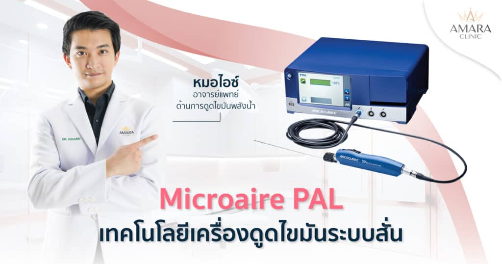 MicroAire PAL เทคโนโลยีดูดไขมัน เหลาหุ่นสวย ด้วยระบบสั่น!