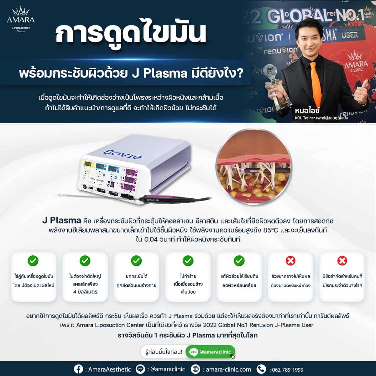 J PLASMA (เจพลาสมา) นวัตกรรมอันดับ 1 ด้านการกระชับผิว
