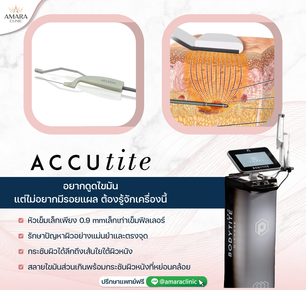ACCUtite เทคโนโลยียกกระชับผิว สลายไขมันในหนึ่งเดียว!
